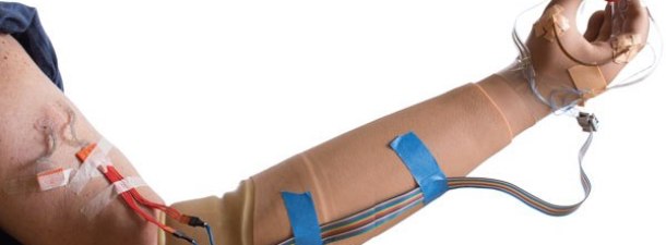 Logran implantar una mano biónica con sentido del tacto
