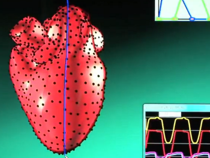 Simulando un corazón desde un portátil y en tres dimensiones
